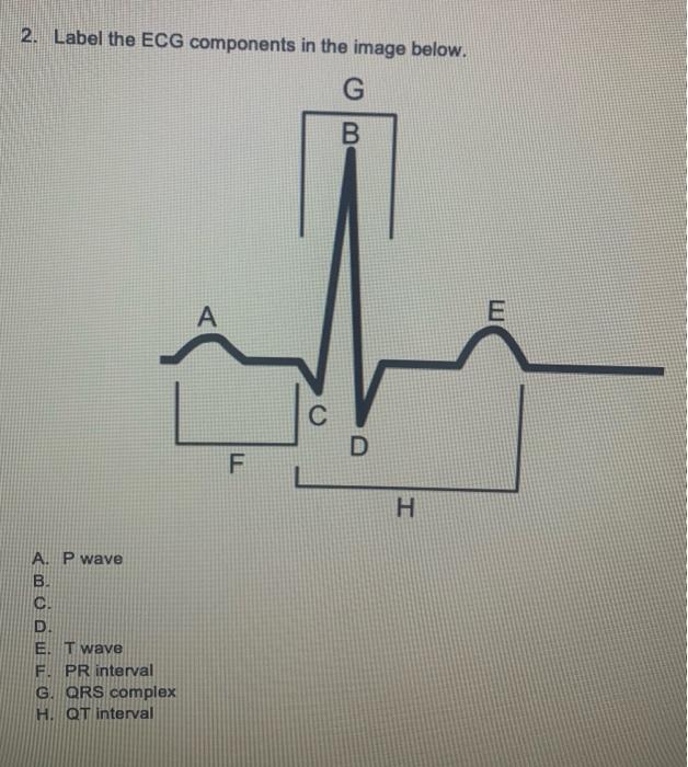 Solved 2. Label the ECG components in the image below. G B A | Chegg.com