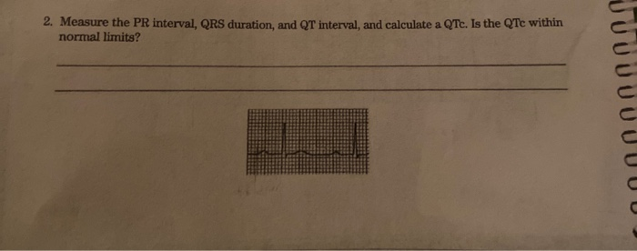 Solved 2. Measure the PR interval, QRS duration, and QT | Chegg.com