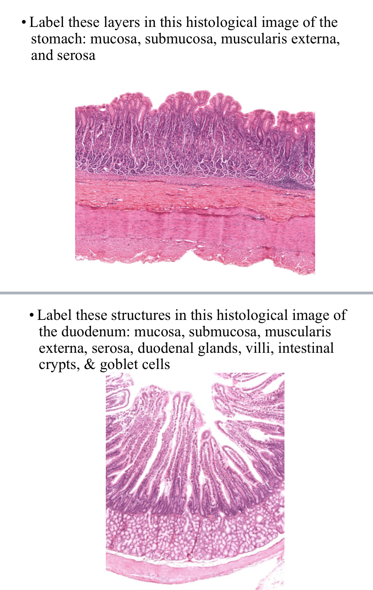 Solved Label these layers in this histological image of the | Chegg.com