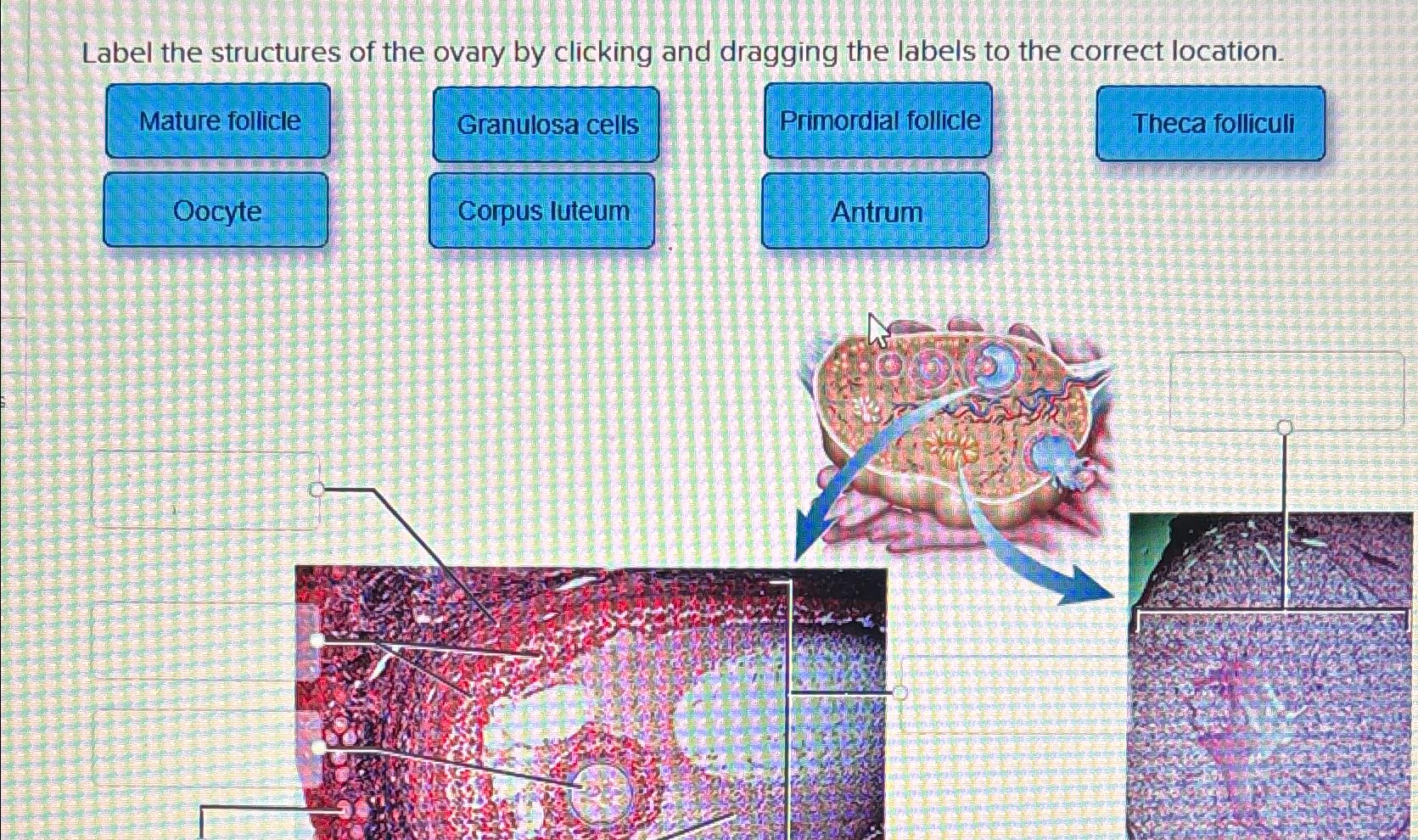 Solved Label the structures of the ovary by clicking and | Chegg.com