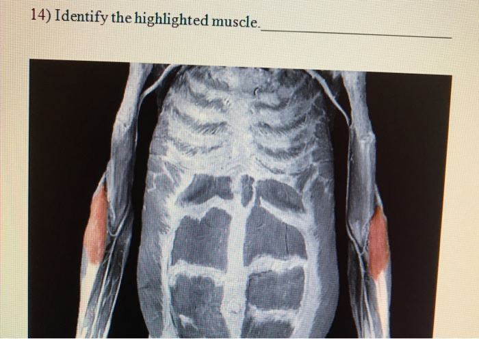 Solved 12) Identify the highlighted muscle. 13) Identify | Chegg.com