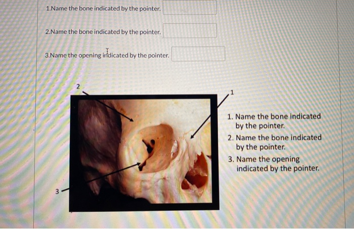 Solved 1.Name the bone indicated by the pointer. 2.Name the | Chegg.com