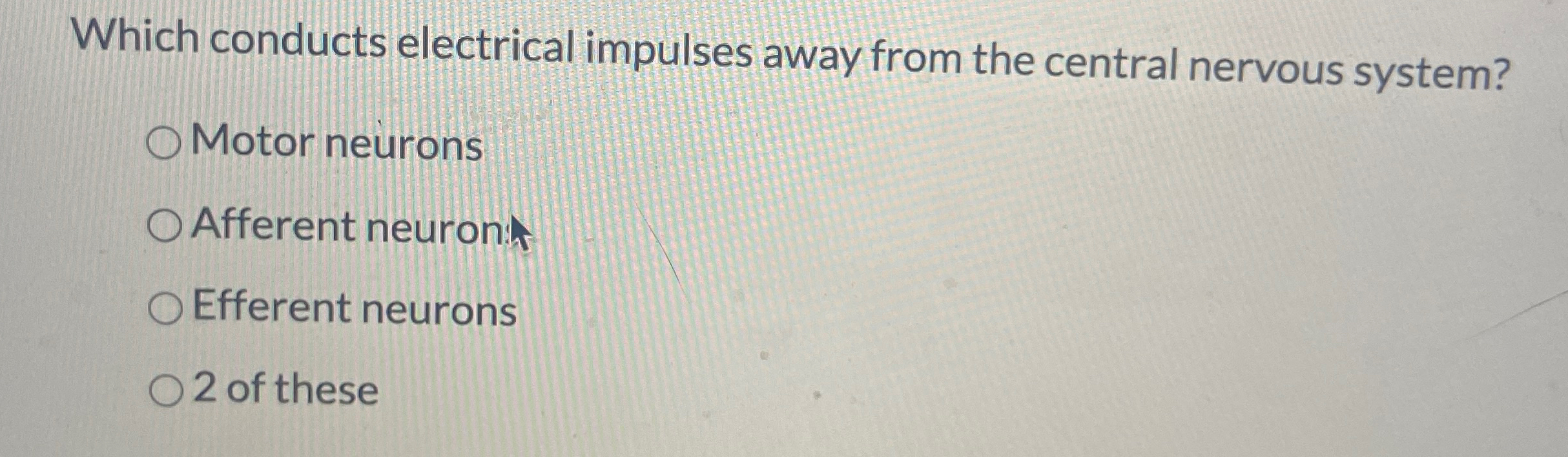 Solved Which conducts electrical impulses away from the | Chegg.com
