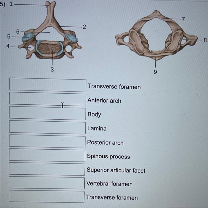 Solved 5) 1 -7 2 6 5 8 4 3 9 Transverse foramen Anterior | Chegg.com