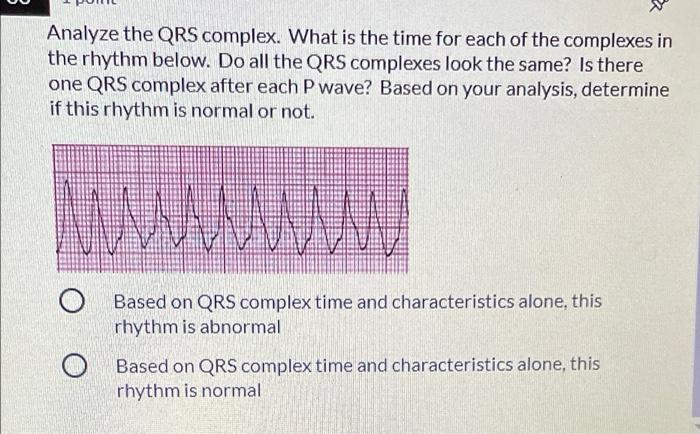 Solved Step 5: Analyze the QRS complex The QRS complex time | Chegg.com