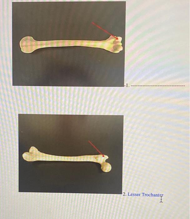 Solved 1. 2. Lesser Trochanter | Chegg.com
