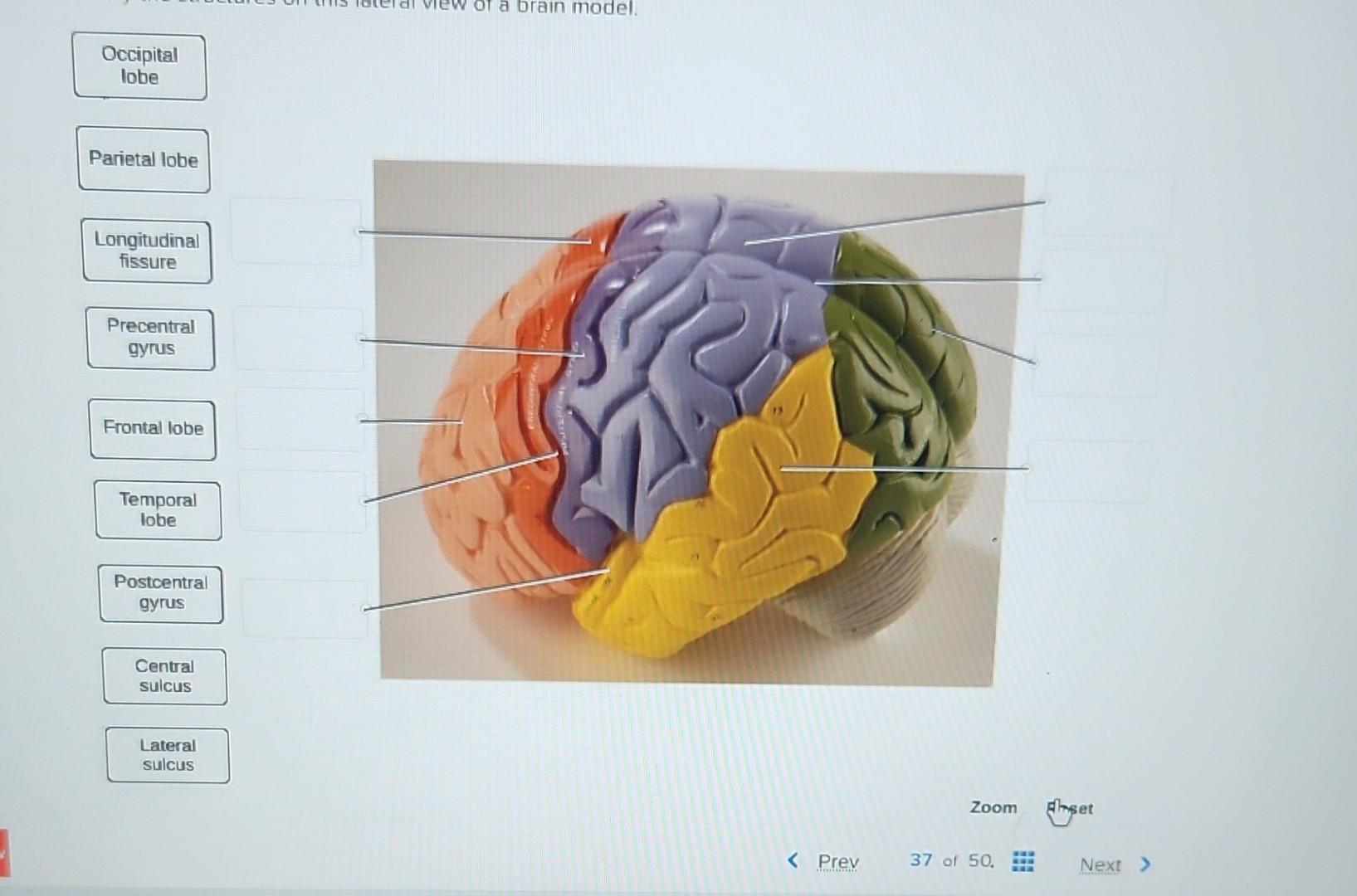 Solved Occipital lobe Parietal lobe Longitudinal fissure | Chegg.com