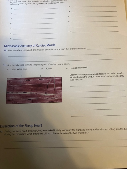 Solved EXERCISE Anatomy OT the Heart Name Lab Time/Date | Chegg.com