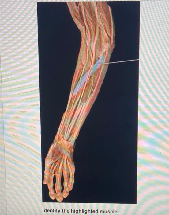 Solved Identify the highlighted muscle. | Chegg.com