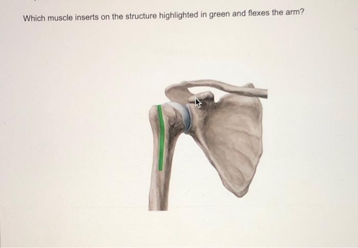 Solved Which muscle inserts on the structure highlighted in | Chegg.com