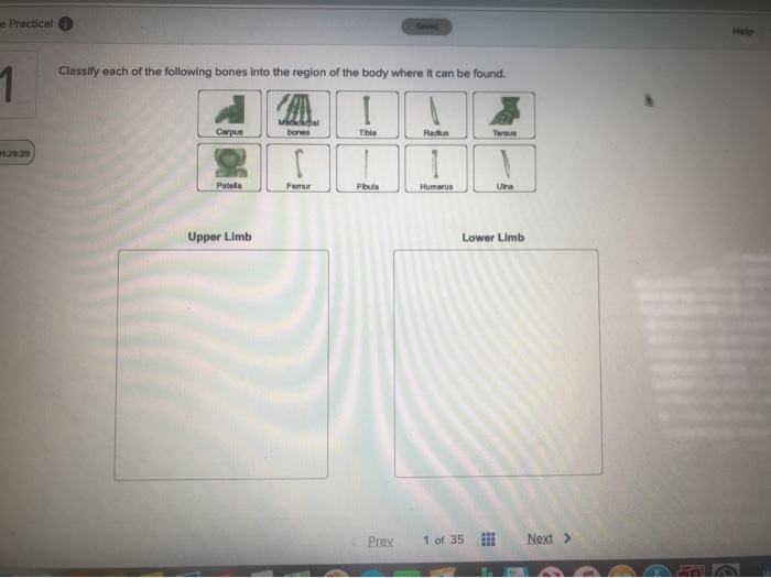 Solved e Practical Halo Classify each of the following bones | Chegg.com