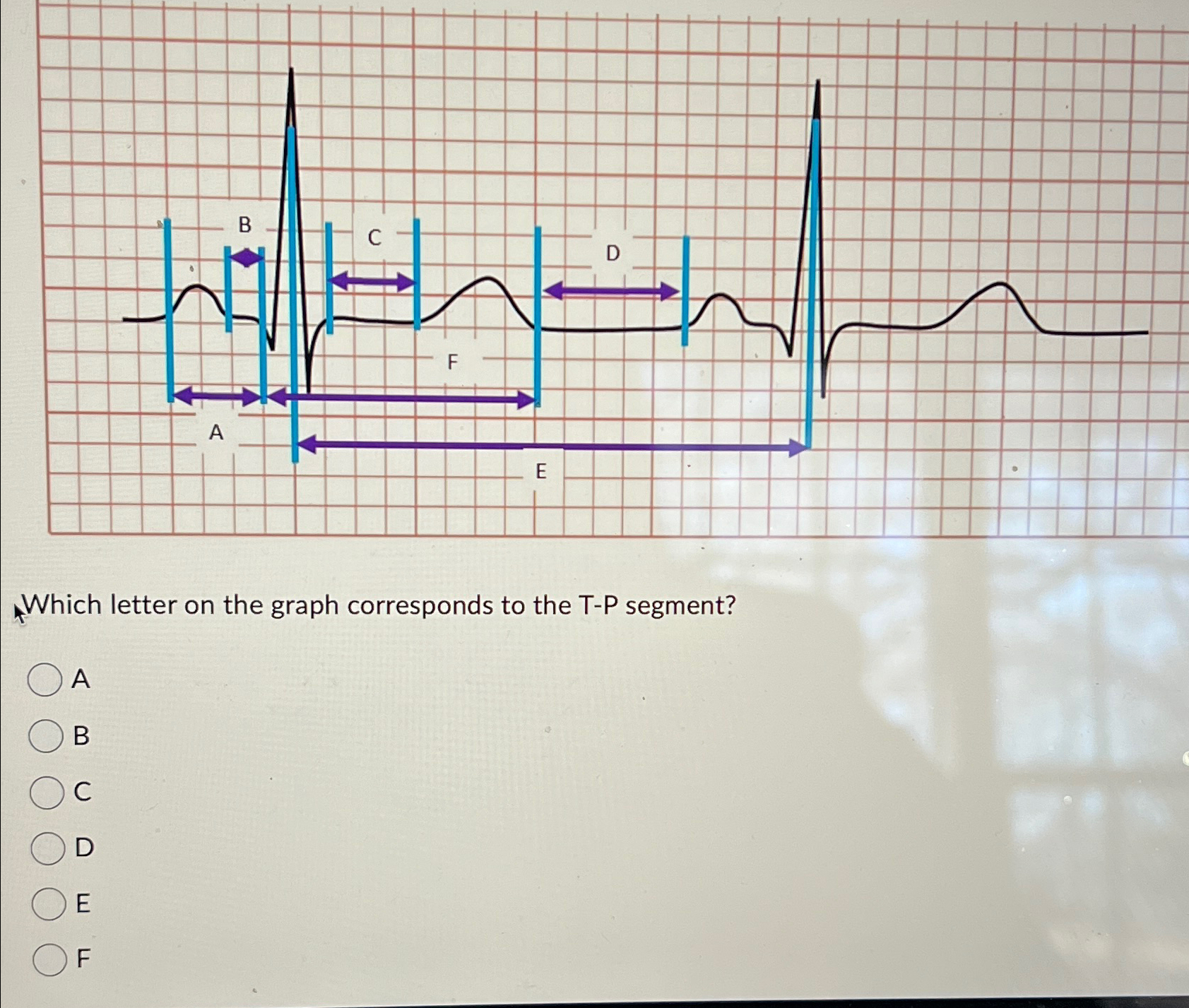 Solved Which letter on the graph corresponds to the T-P | Chegg.com