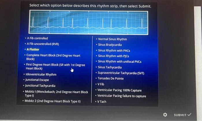Solved Select which option below describes this rhythm | Chegg.com