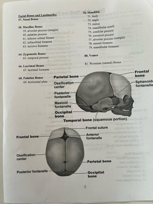 1. coronal 2. sagittal 3. lambdoidal 4. squamosal | Chegg.com
