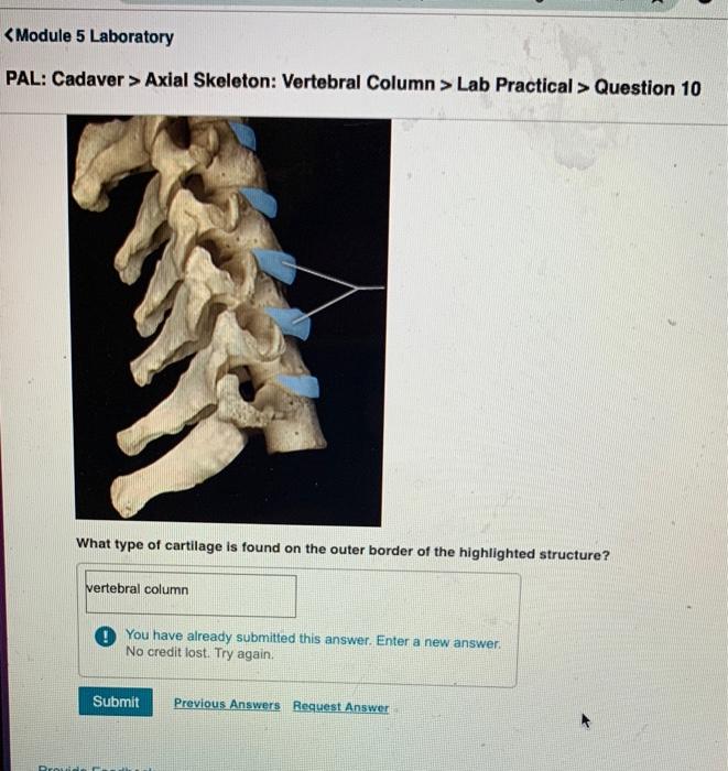 Solved Axial Skeleton: Skull > Lab Practical > Question 15 | Chegg.com