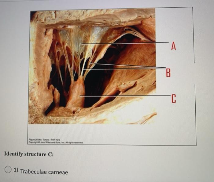 Solved A. B C TAP GWWww Identify structure C: 1) Trabeculae | Chegg.com