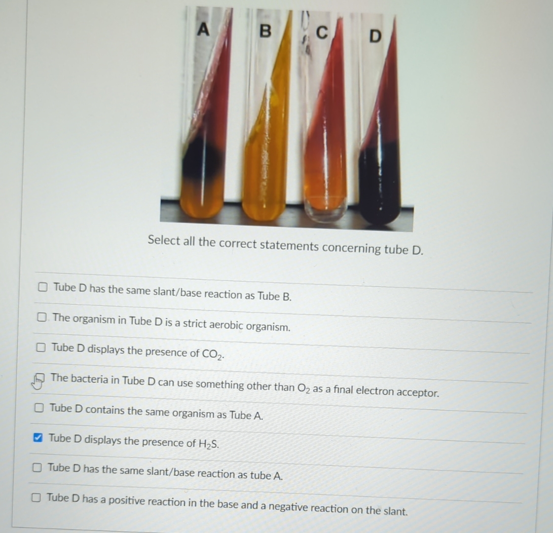 Solved select all the correct statements concerning tube | Chegg.com