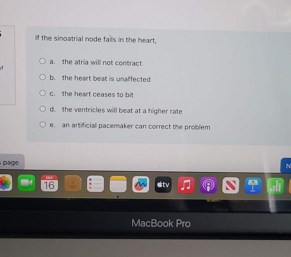 Solved If the sinoatrial node fails in the heart, a. the | Chegg.com