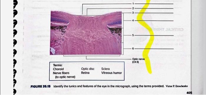 Solved FIGURE 35.15 Identify the tunics and features of the | Chegg.com