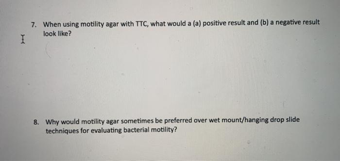 Solved 7. When using motility agar with TTC, what would a | Chegg.com