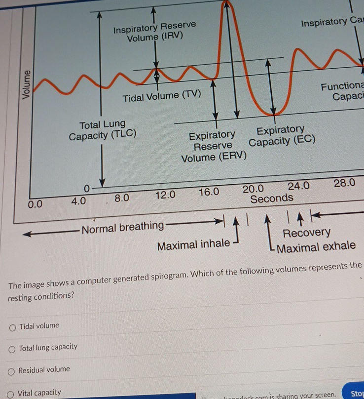 Solved The image shows a computer generated spirogram. Which | Chegg.com