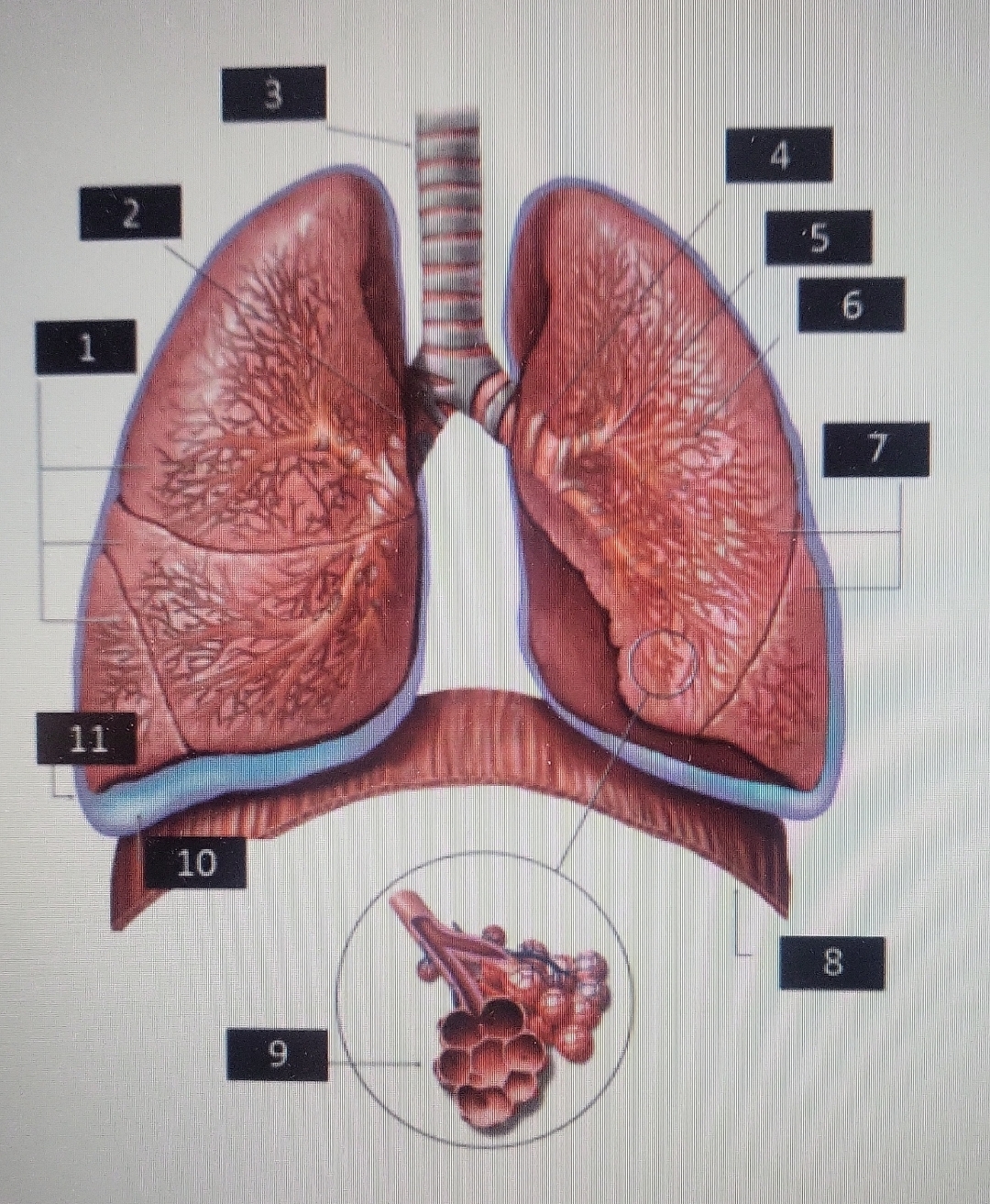 Solved bronchi, pleural fluid, right main stem bronchus, | Chegg.com