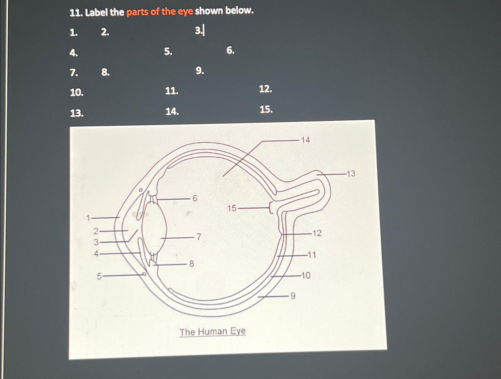 Solved Label the parts of the eye shown below1.2.3.4.5.6.7. | Chegg.com