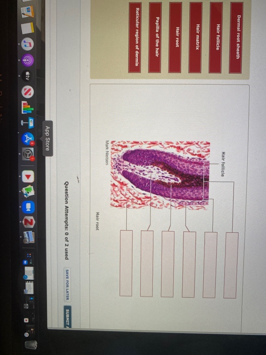 Solved Dermal root sheath Hair follicle Hair follicle Hair | Chegg.com