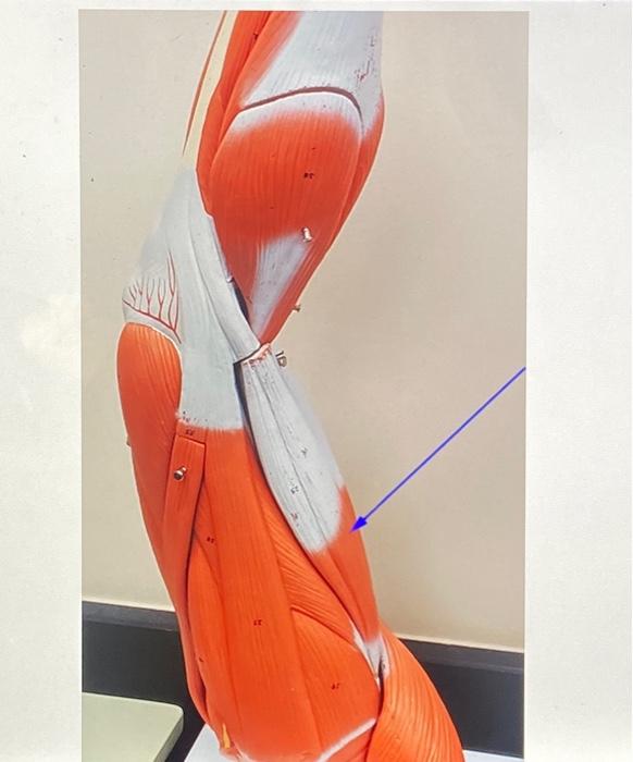 identify the muscle | Chegg.com