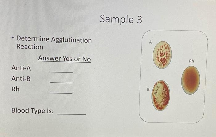Solved Sample 3 • Determine Agglutination Reaction Answer | Chegg.com