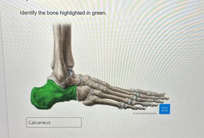 Solved Identify the bone highlighted in green. | Chegg.com