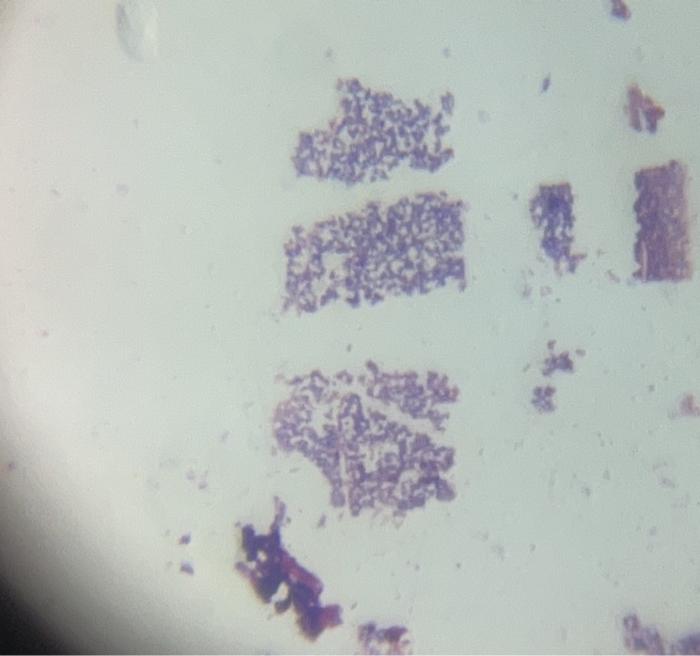 Solved list the possible bacterial microorganisms in the | Chegg.com