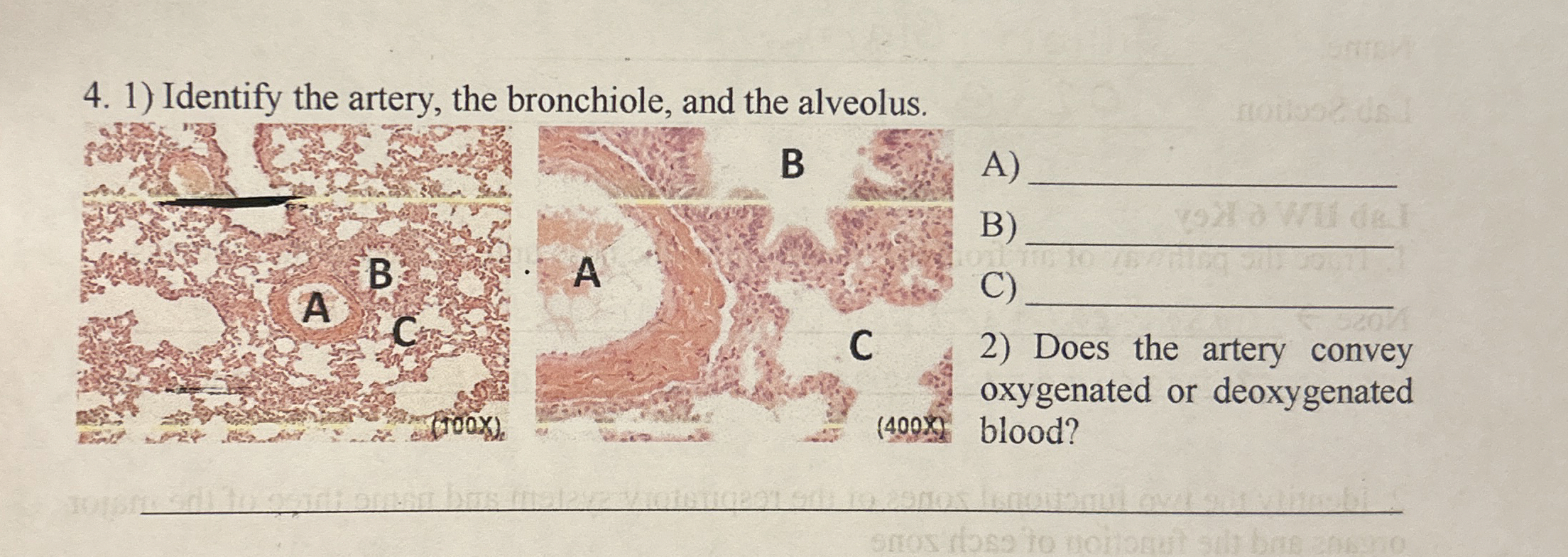 Solved Identify the artery, the bronchiole, and the | Chegg.com