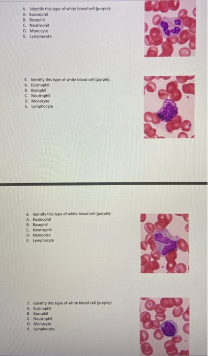 Solved 4. Identify this type of white blood cell (purple): A | Chegg.com