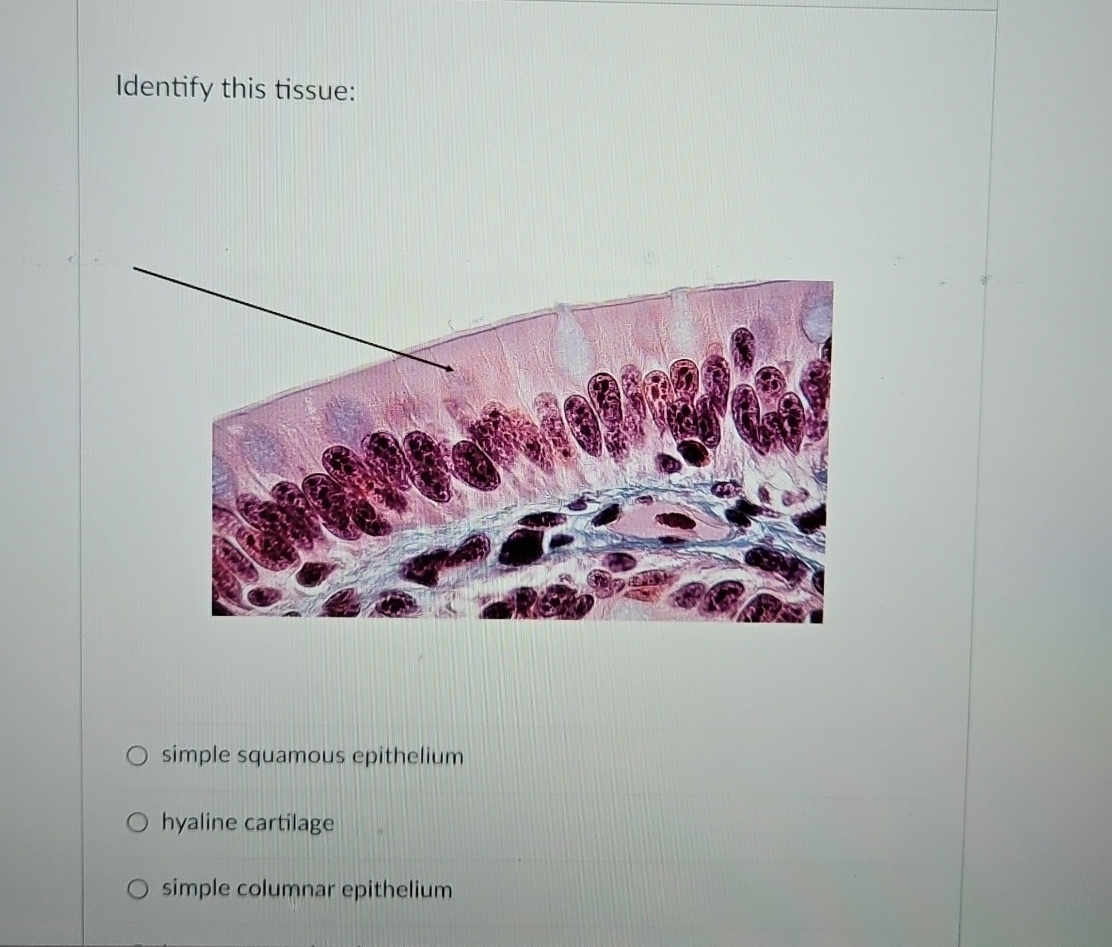 Solved Identify this tissue:simple squamous | Chegg.com