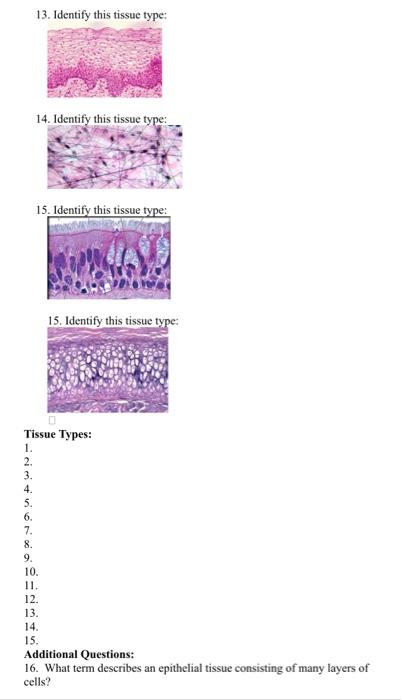 Solved Tissue Identification Worksheet Identify the | Chegg.com