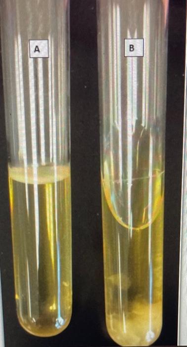 Solved which zone is positive on this starch plate? what | Chegg.com