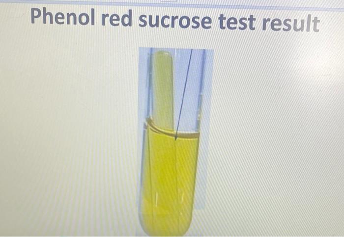 Solved Phenol red sucrose test result | Chegg.com
