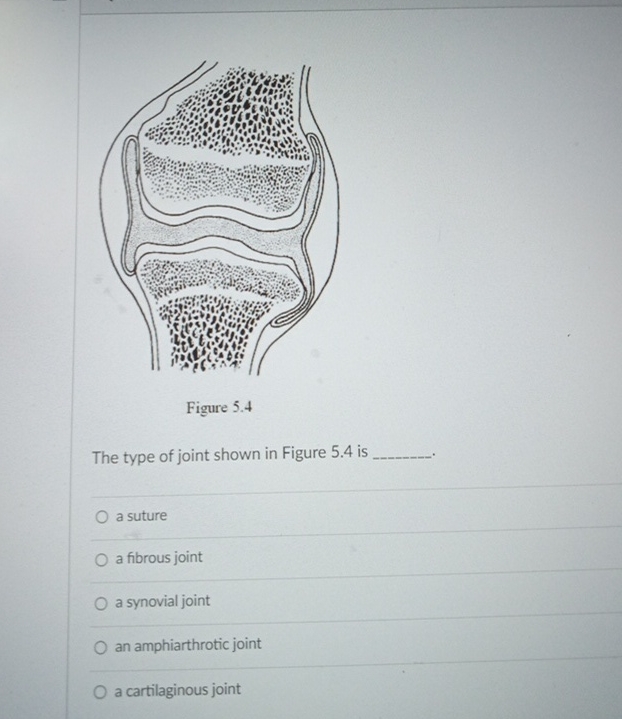 Solved The type of joint shown in Figure ﻿is a suturea | Chegg.com