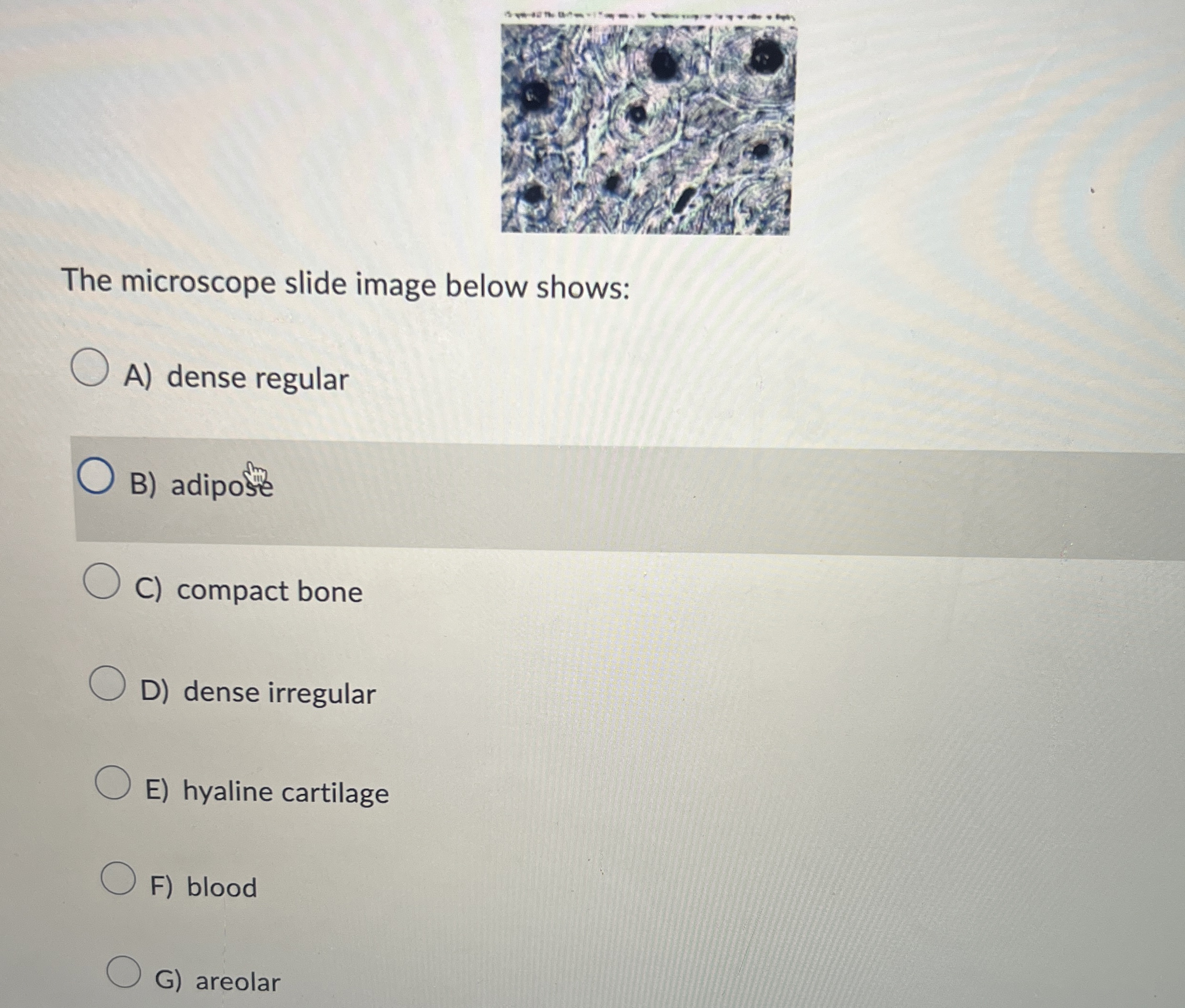 Solved The microscope slide image below shows:A) ﻿dense | Chegg.com