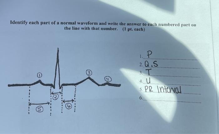 Solved Identify each part of a normal waveform and write the | Chegg.com