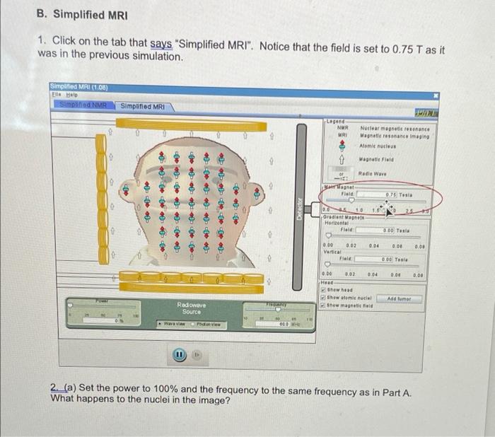 Solved B. Simplified MRI 1. Click on the tab that says | Chegg.com