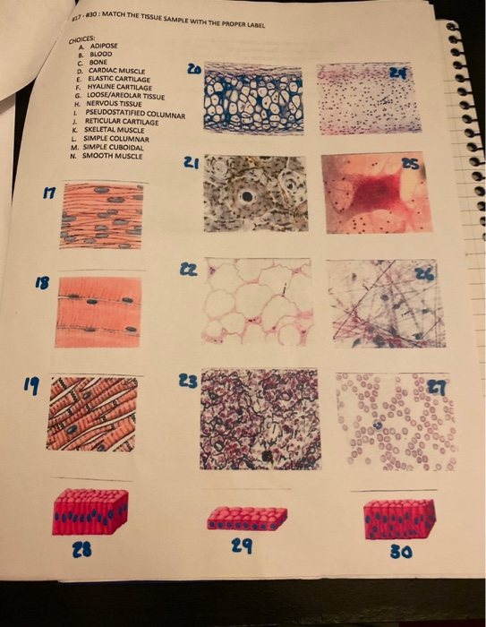 Solved JO: MATCH THE TISSUE SAMPLE WITH THE PROPER LABEL | Chegg.com