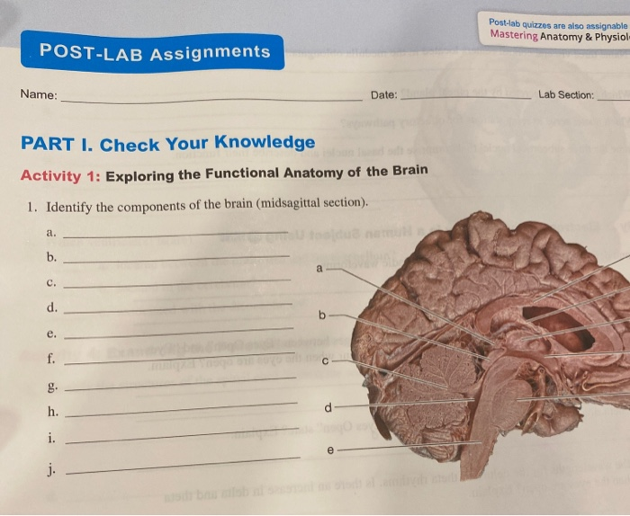 Solved Post Lab Quizzes Are Also Assignable Mastering