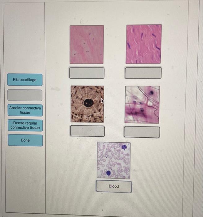 Solved Fibrocartilage Areolar connective tissue Dense | Chegg.com