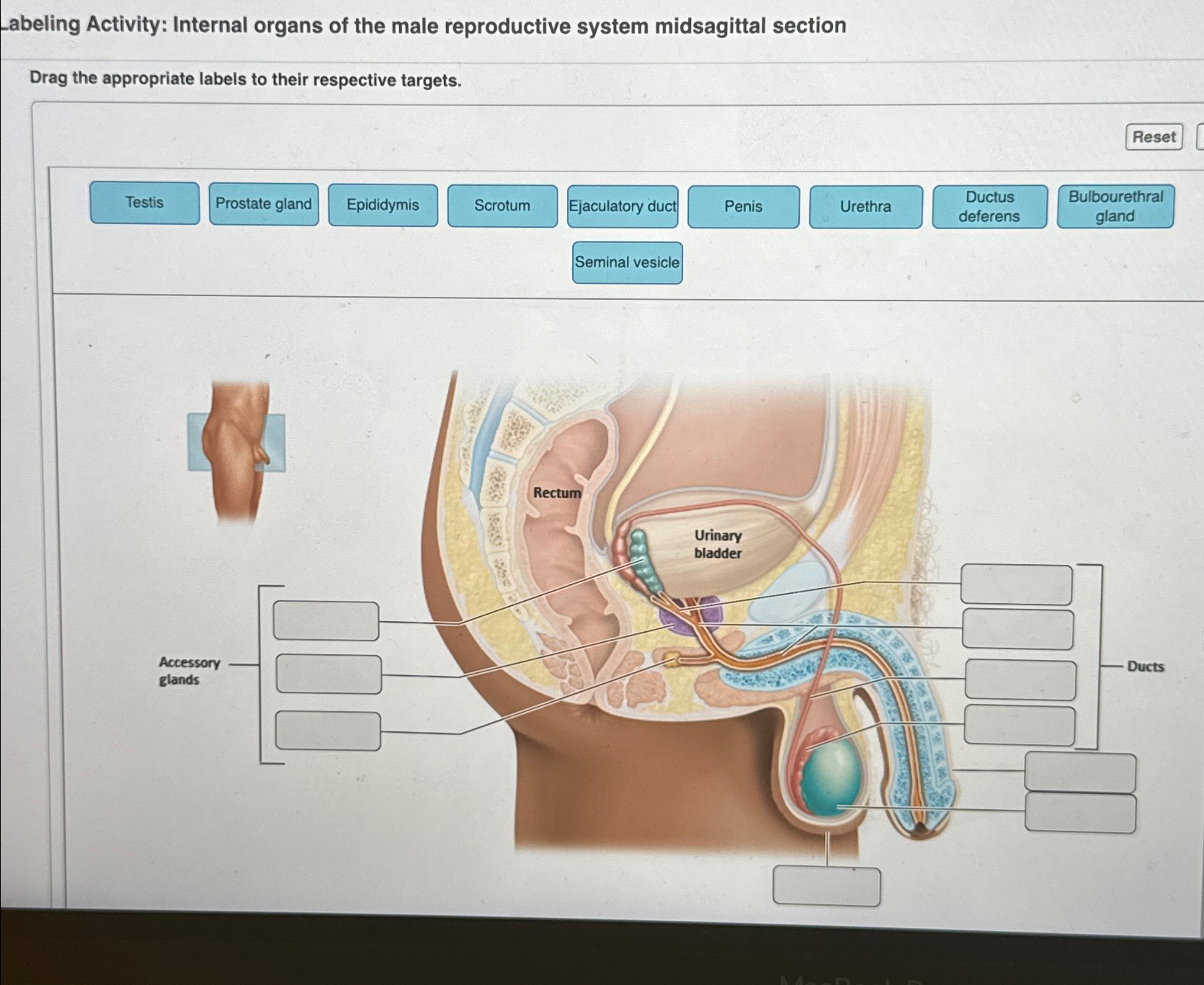 Solved Labeling Activity: Internal organs of the male | Chegg.com