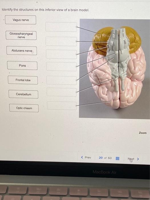 Solved Identify the structures on this midsagittal view of a | Chegg.com
