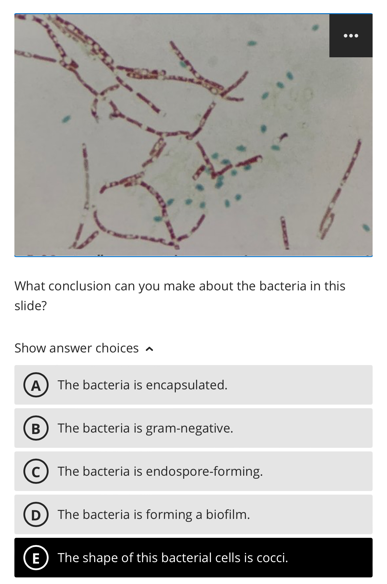 Solved What conclusion can you make about the bacteria in | Chegg.com