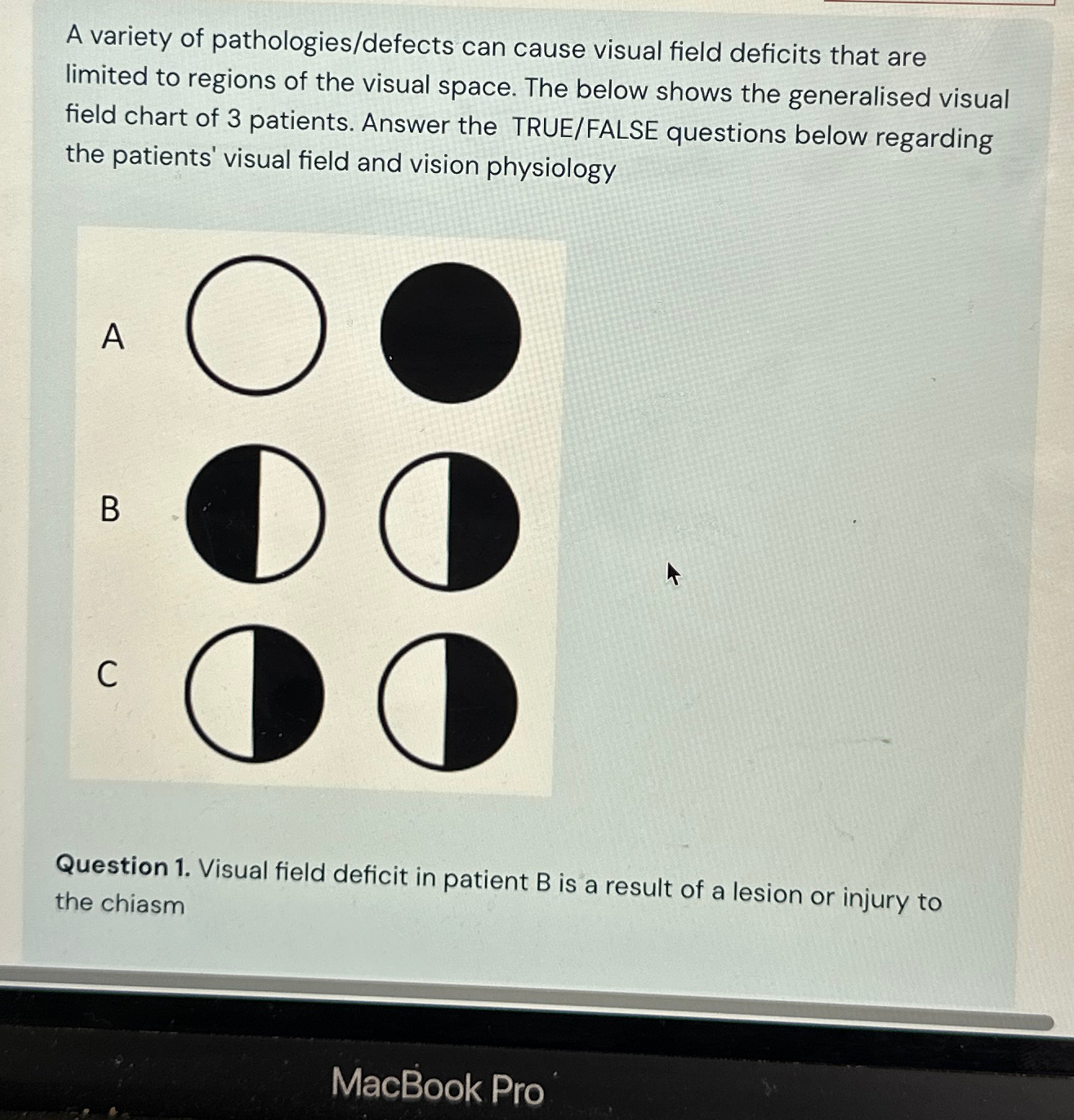 Solved A variety of pathologies/defects can cause visual | Chegg.com