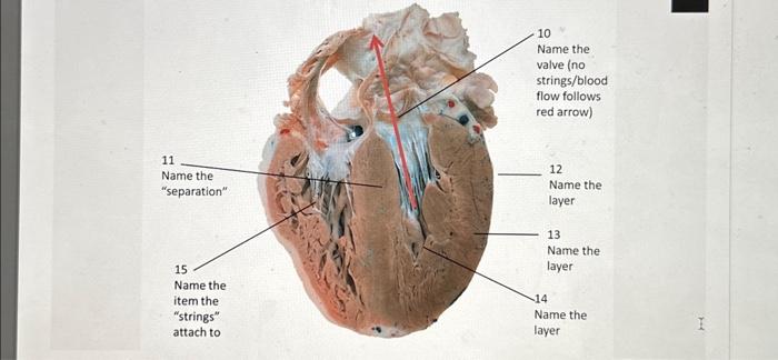 Solved identify the parts of the heart | Chegg.com